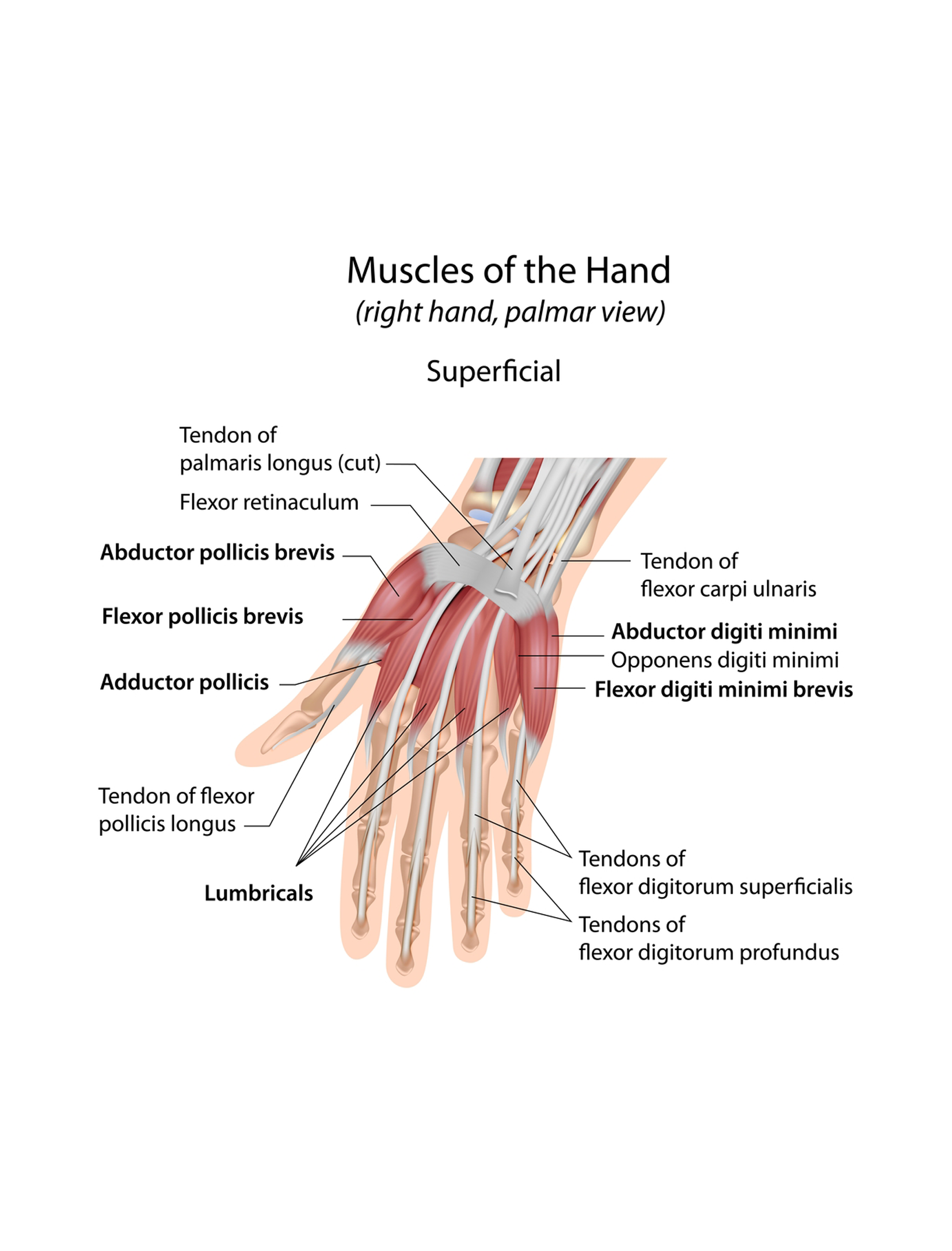Lésion du tendon fléchisseur du doigt à Bordeaux | Institut aquitain de ...