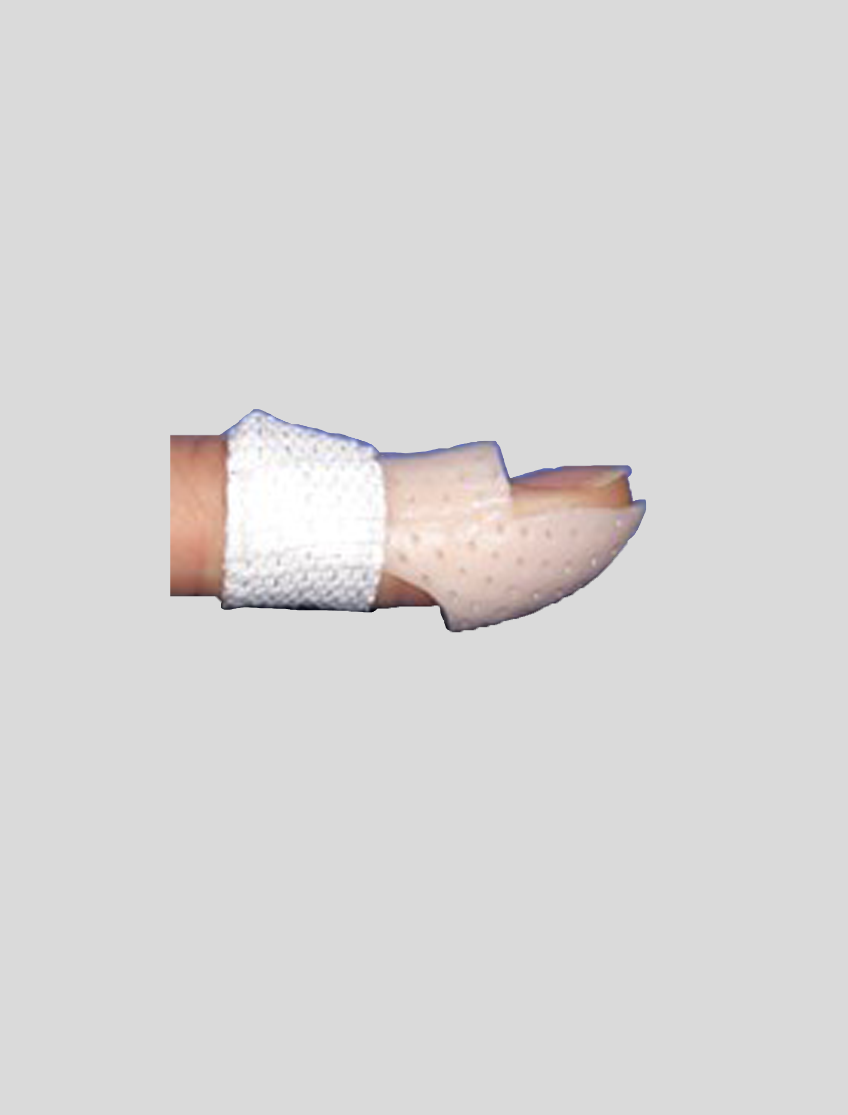 Mallet finger ou doigt en maillet | Institut Aquitain Main