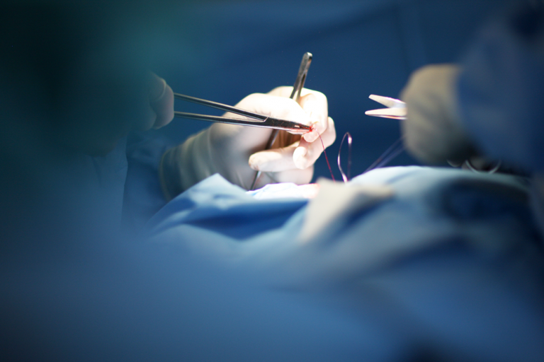 Arthrose STT du poignet | Institut Aquitain Main Bordeaux